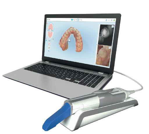 How Intraoral Scanners Are Used in Full-Arch Workflows
